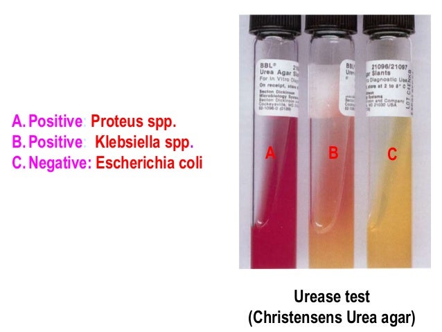 Biochemical tests for identification of bacteria