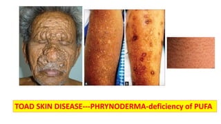 Biochemical tests for purity of fats & oils | PDF