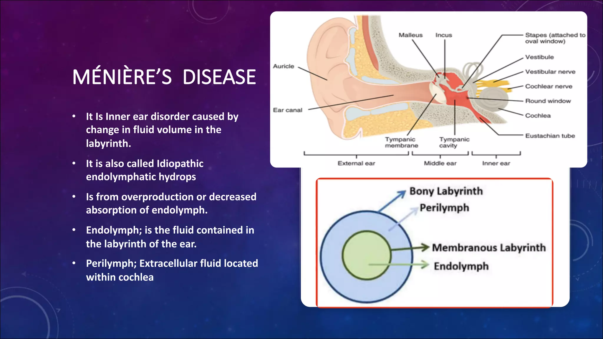 Ménière’s disease Ömer aslankan | PDF