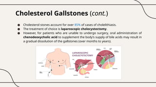 Biochemistry of Gallstones for medical doctors | PPTX