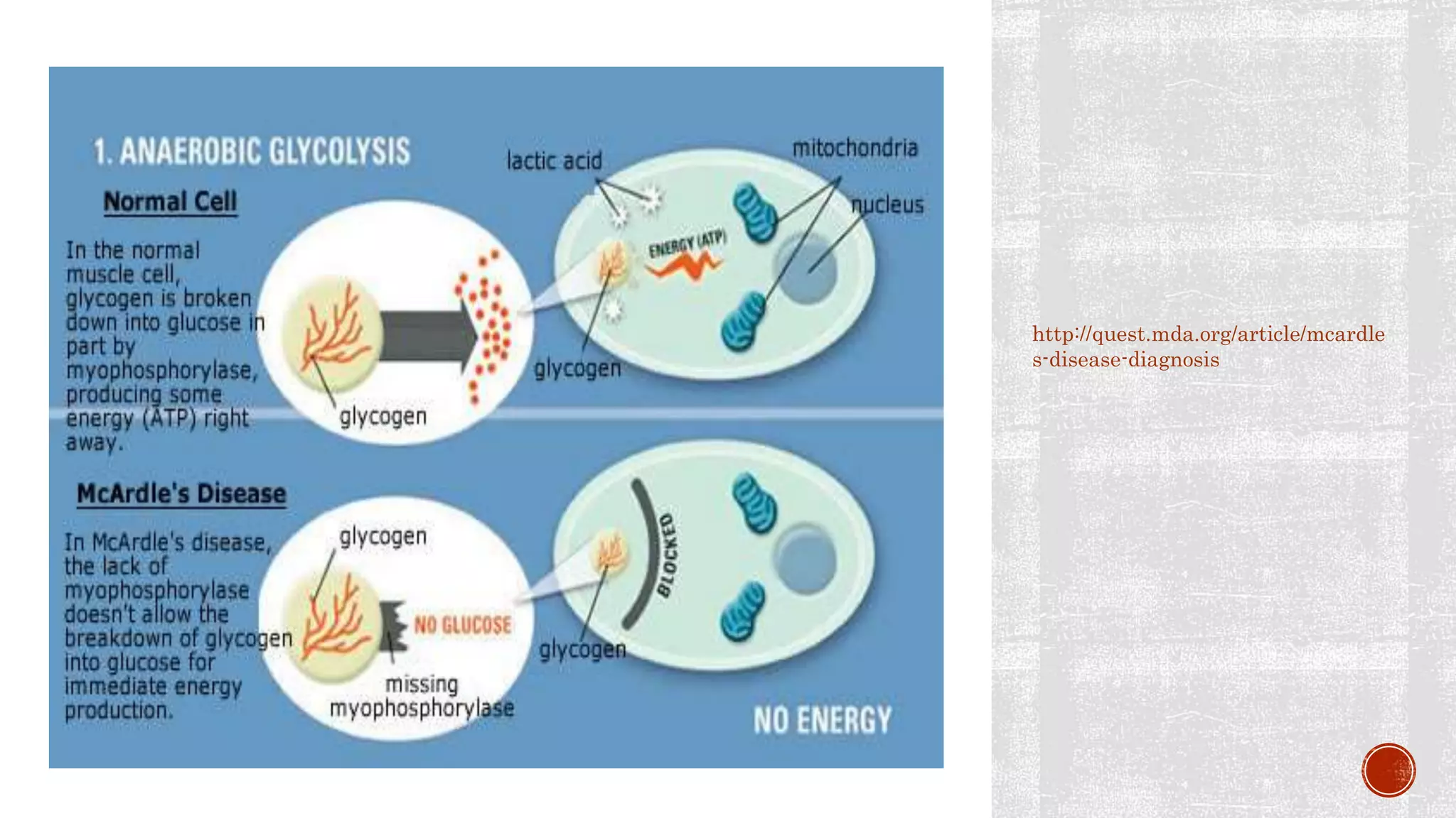 Biochemistry of McArdles disease | PPTX