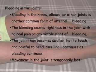 Bio chem presentation on hemophilia | PPTX