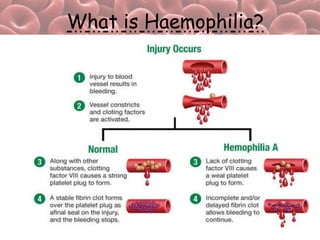 Bio chem presentation on hemophilia | PPTX