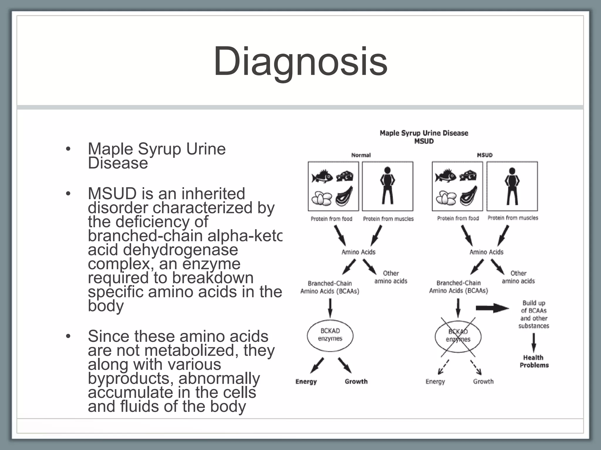 Maple Syrup Urine Disease | PPTX