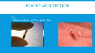Bio—chip ] sensor | PPT