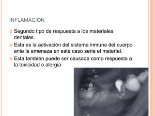Biocompatibilidad en materiales | PPTX