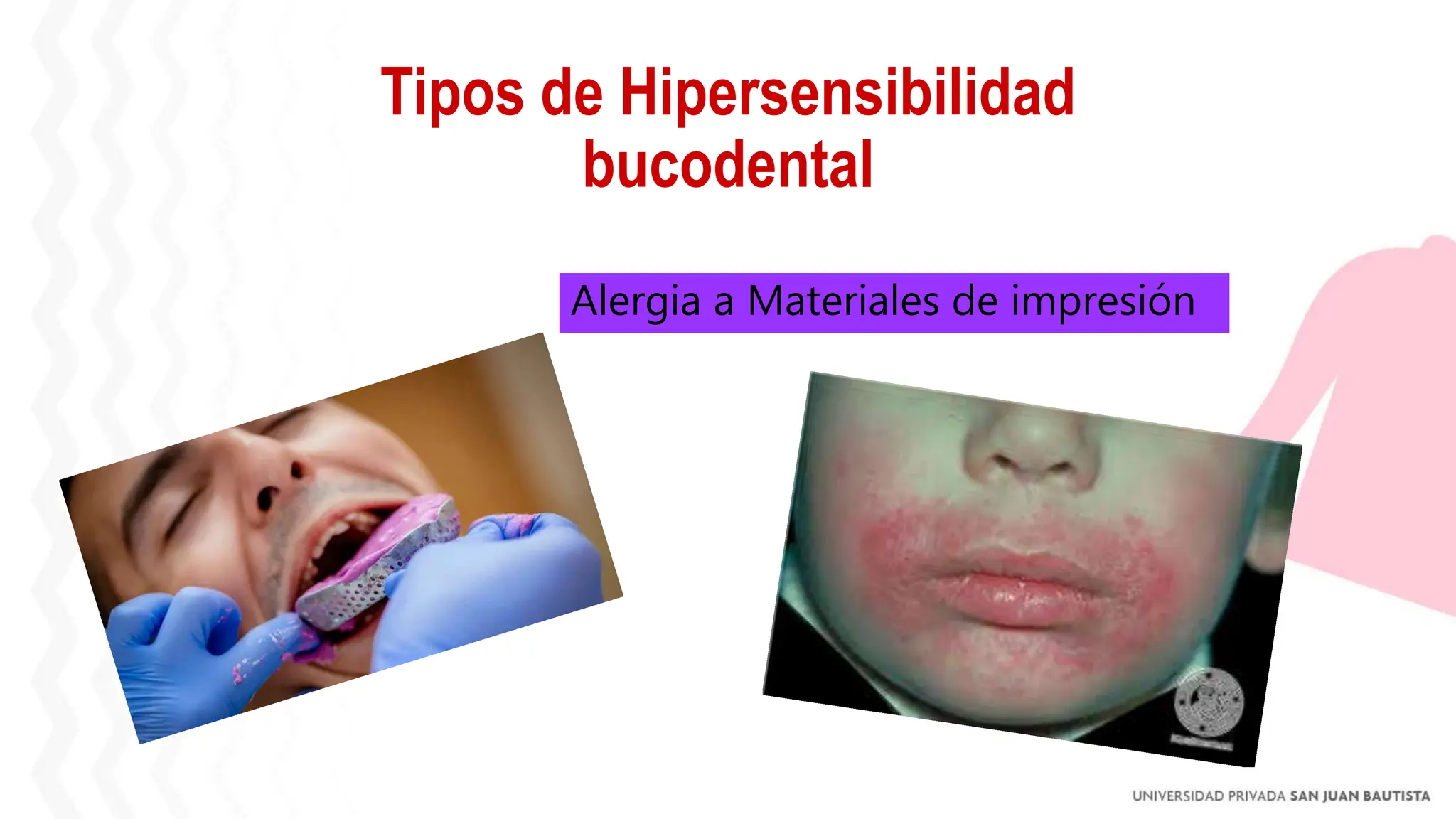 Biocompatibilidad, reacciones alergicas y bioseguridad.ppt