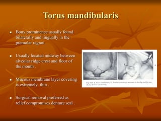 bio consideration in mand impressions.ppt