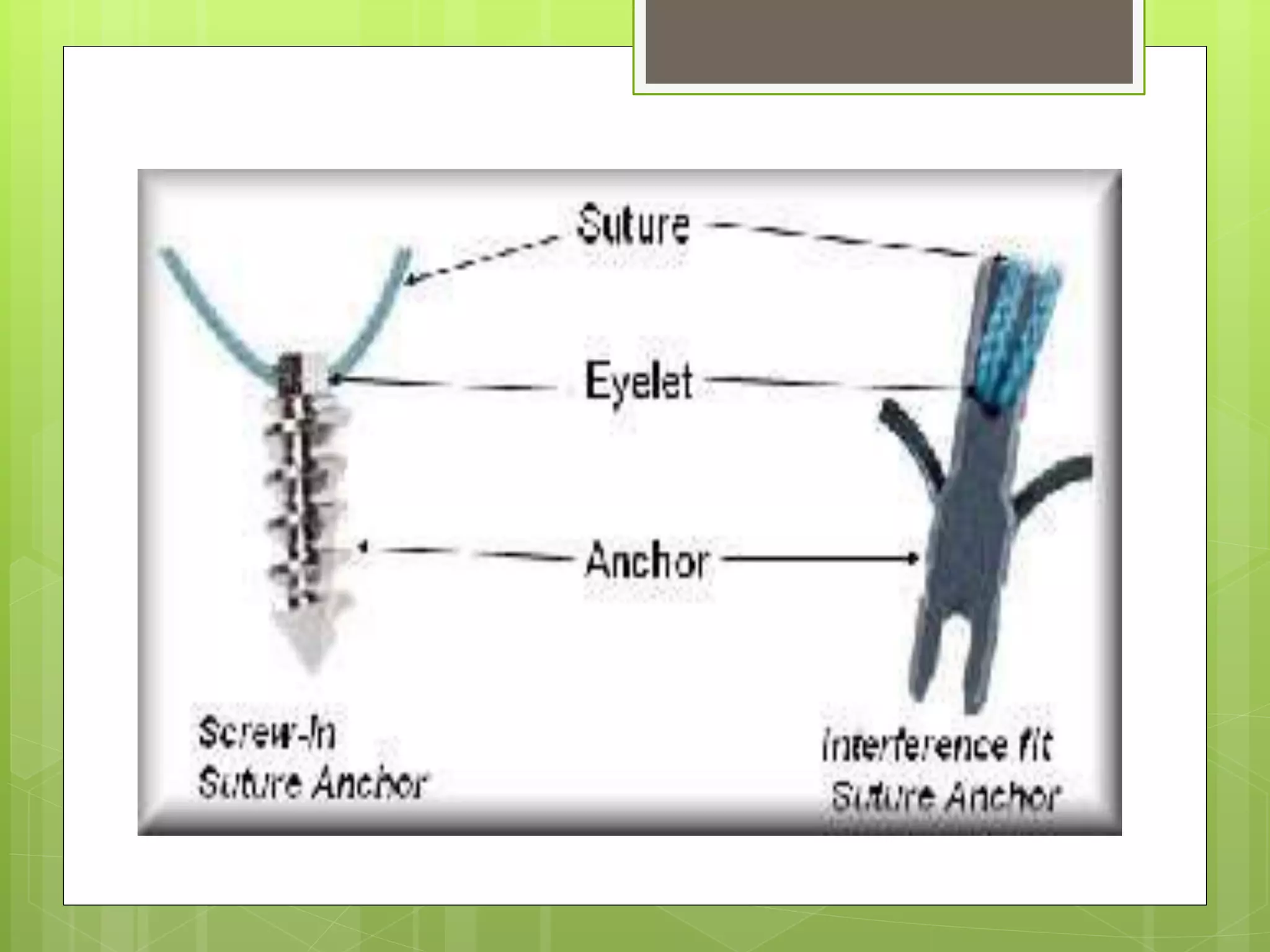 Biodegradable implants | PPTX