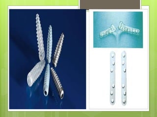 Biodegradable implants | PPTX