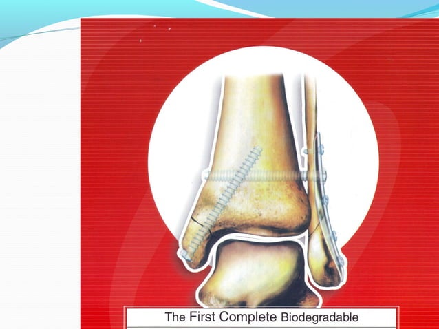 Biodegradable implants