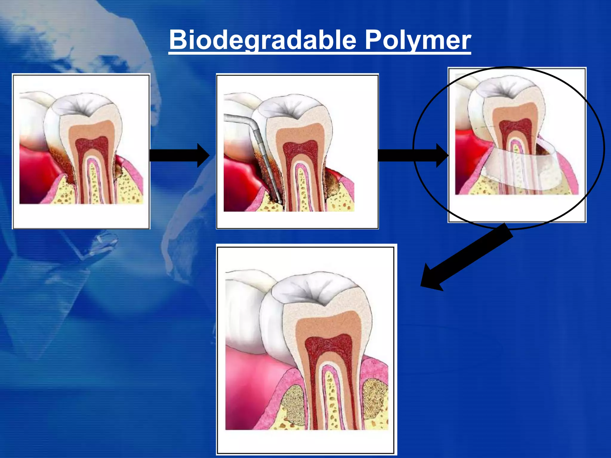 Biodegradable_Polymers_Use_In_dental_Application.pptx Biodegradable_Polymers_Use_In_dental_Application.pptx