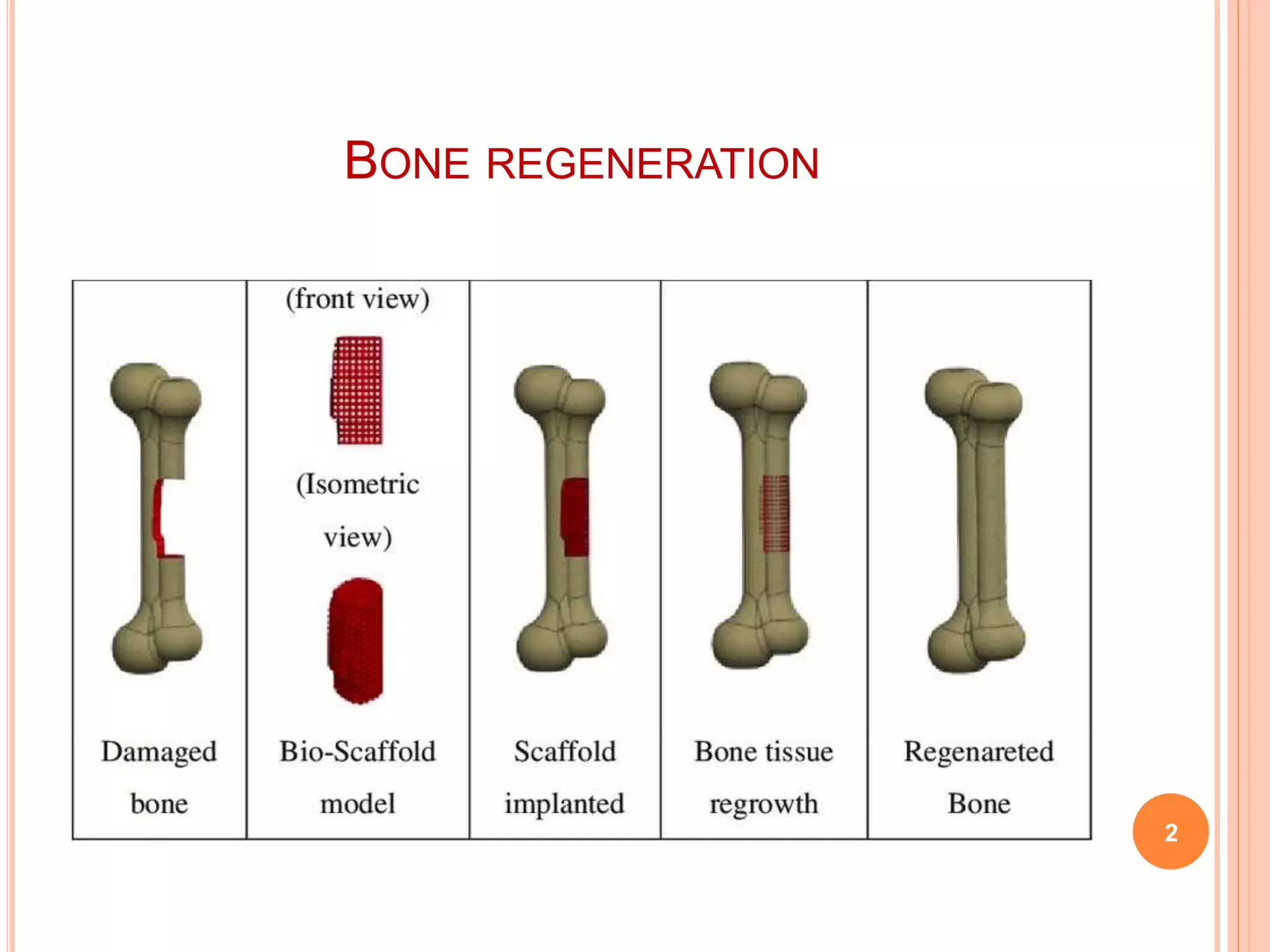 Biodegredable metals for bone regeneration | PPTX