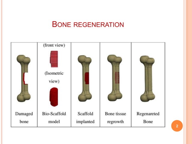 Biodegredable metals for bone regeneration | PPTX | Chemistry | Science