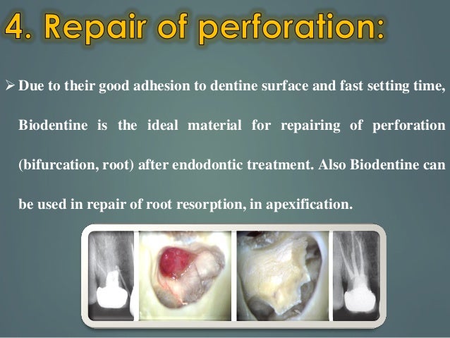 Biodentine™