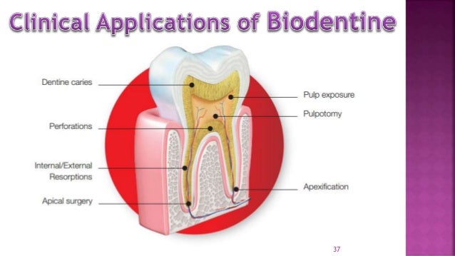 Biodentine