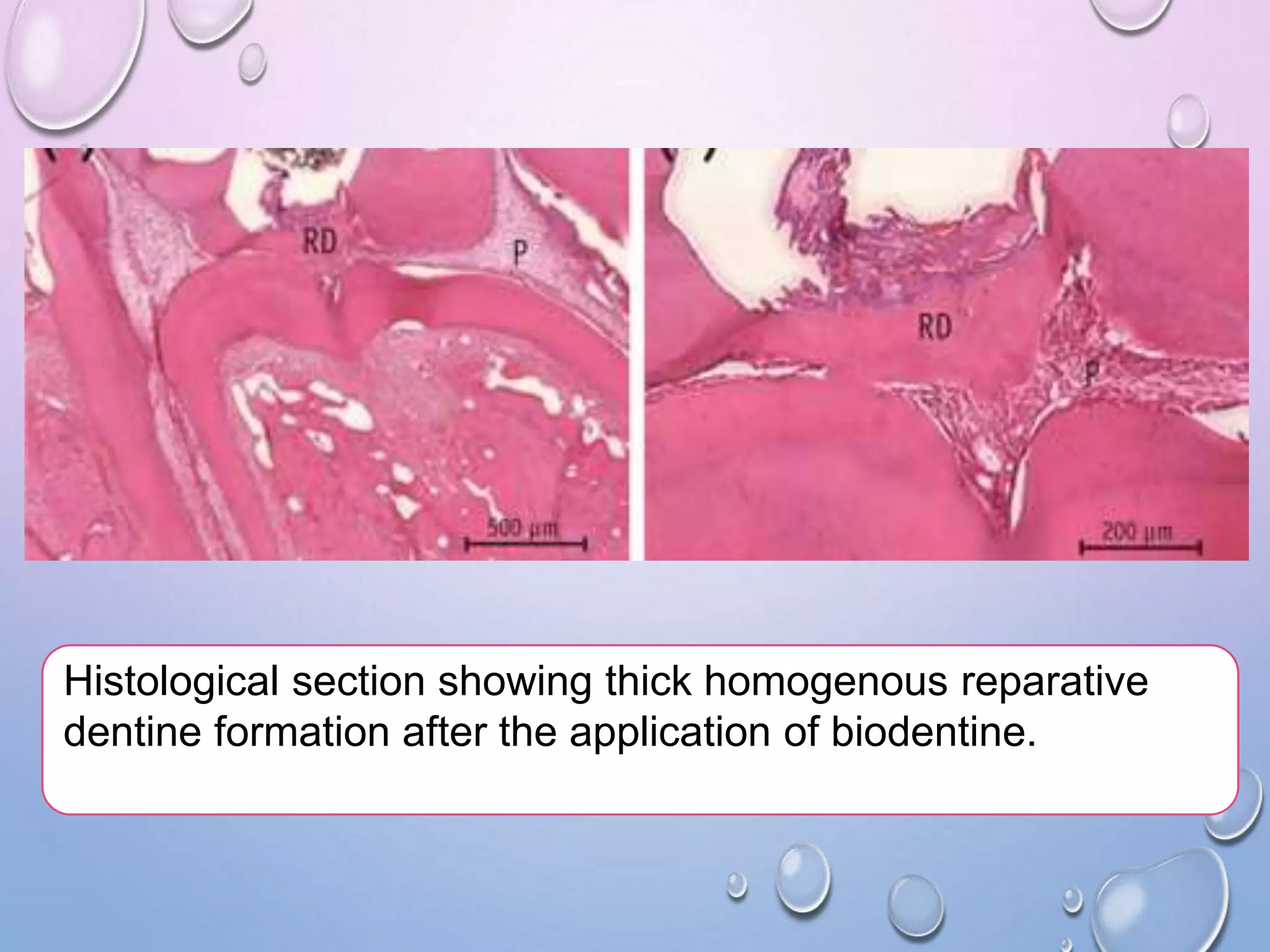 Biodentine (newer material in dentistry) | PPTX