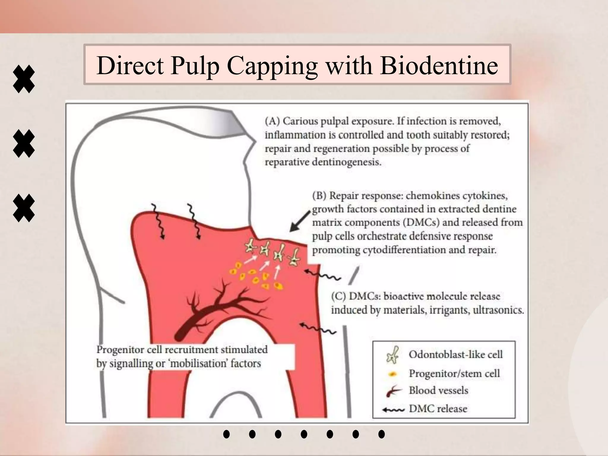 biodentine dpc.pptx