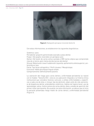 biodentine hmi.pdf