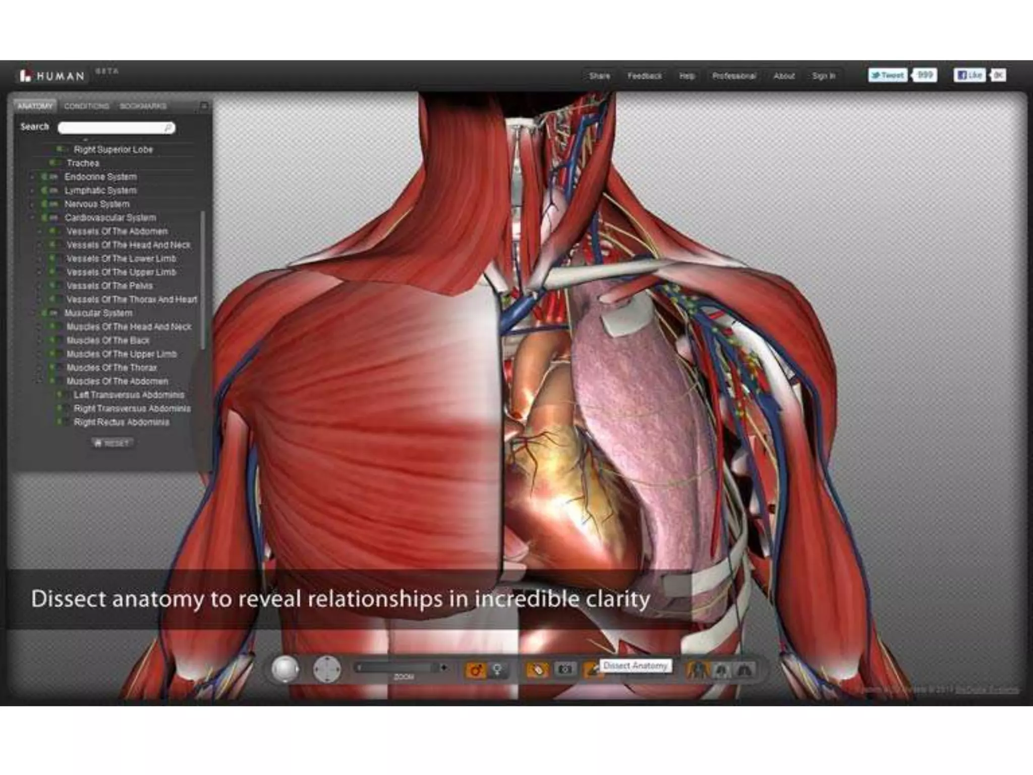 BioDigitalSystems Human Body | PPTX