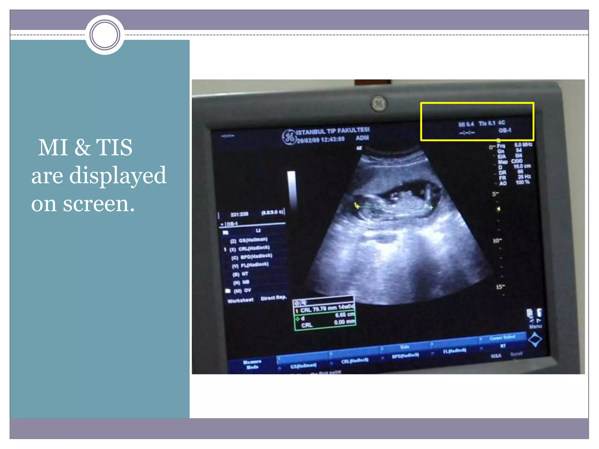 Bioeffect Of Ultra Sound | PPTX