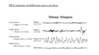 types of bioelectric potentials and their measurement | PPTX
