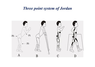 Orthotics and Splints | PDF