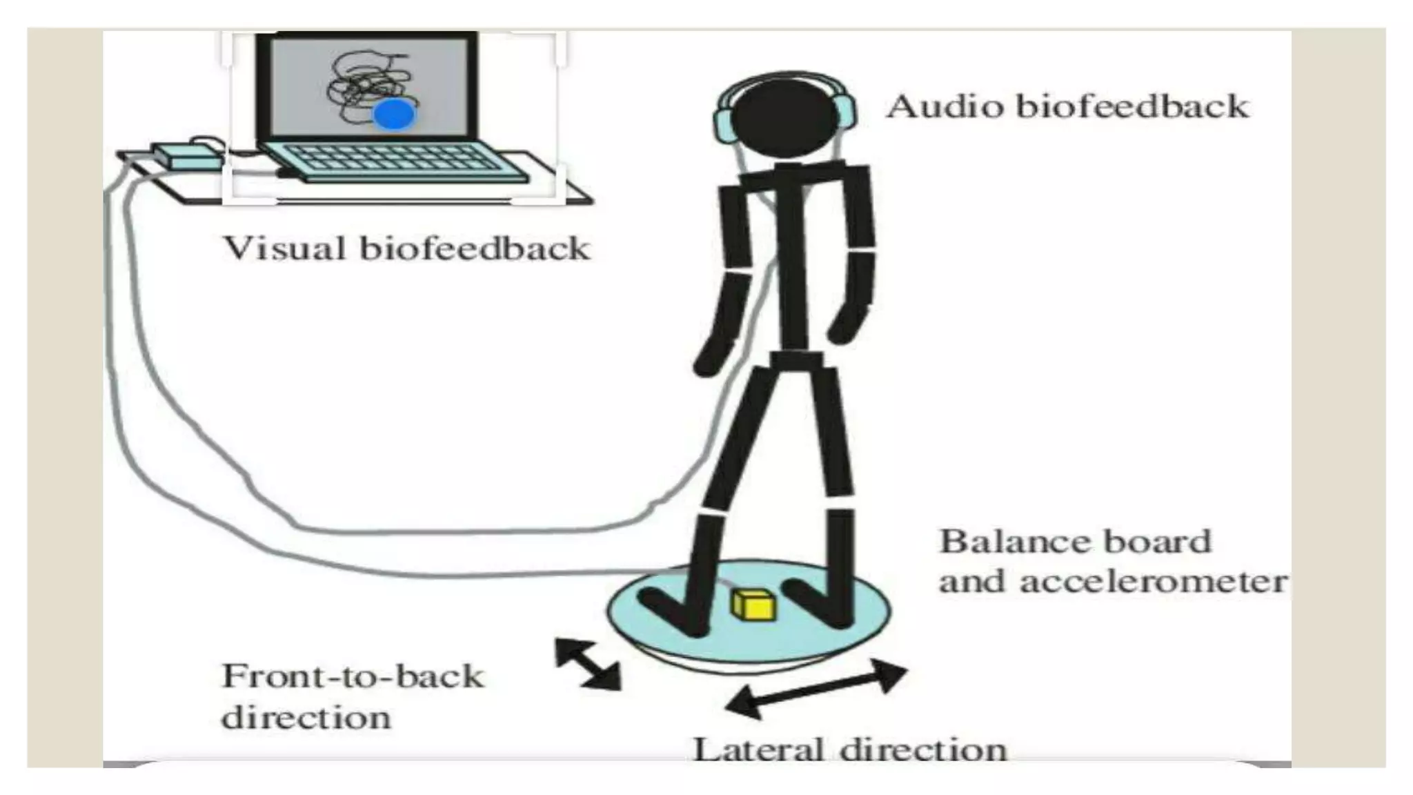 Biofeedback in neurorehabilitation by arfa sulthana | PPTX