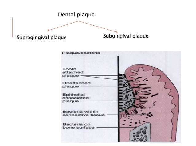 Dental Plaque/Biofilm | PPTX | Oral care | Personal Care