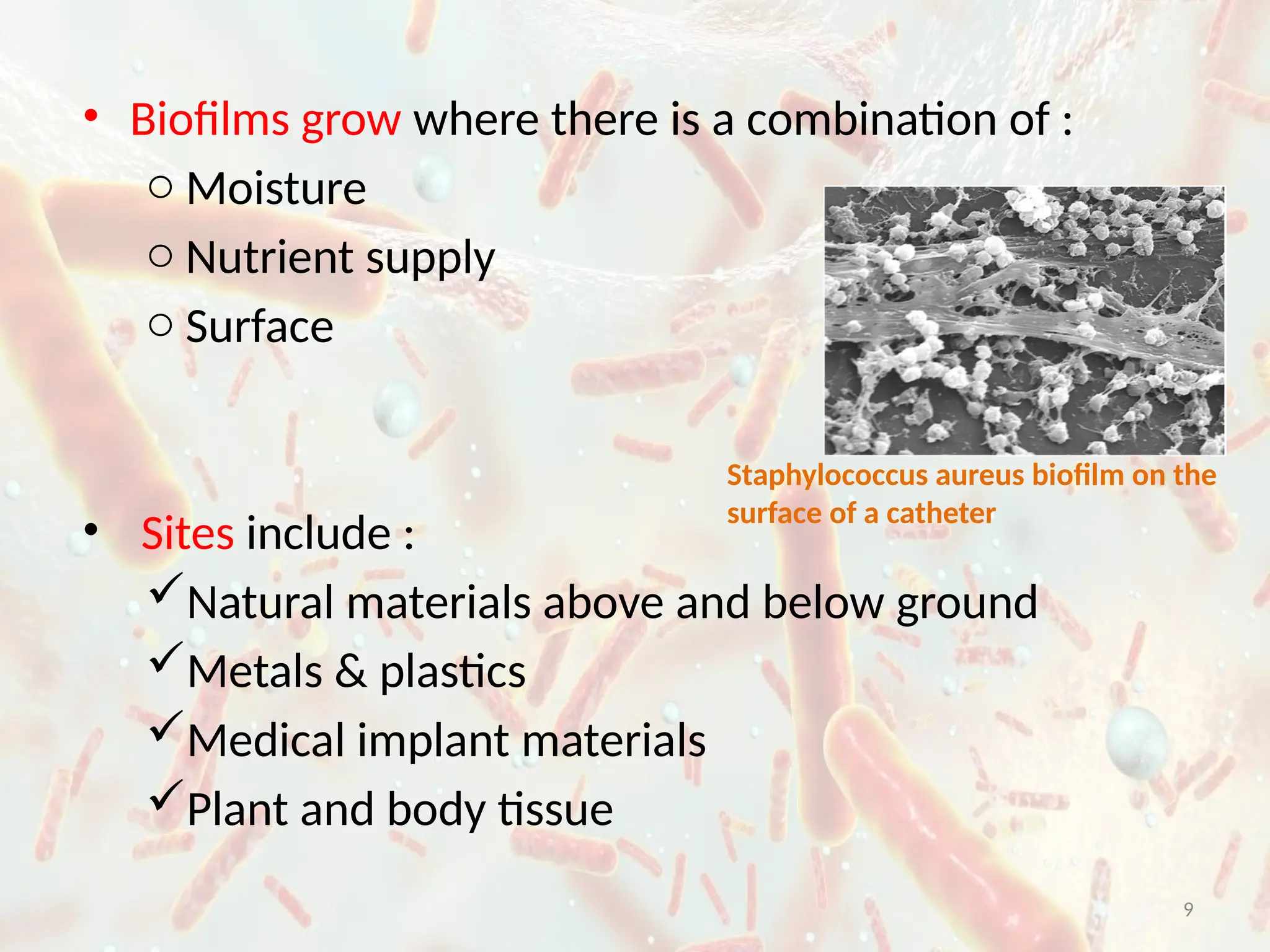 biofilm and its significance in endodontics.pptx | Dental Health | Diseases and Conditions