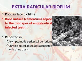 biofilm and its significance in endodontics.pptx