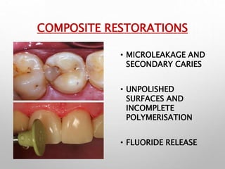 Bacterial Biofilm formation on different biomaterials | PPT