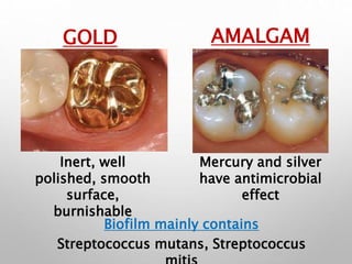 Bacterial Biofilm formation on different biomaterials | PPT