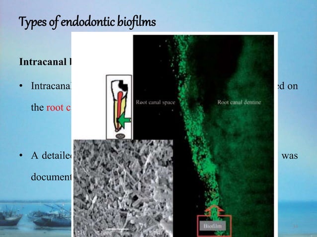 Endodontic Biofilms and management..pptx | Dental Health | Diseases and Conditions