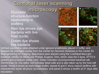 Biofilms in chronic suppurative otitis media and cholesteatoma | PPTX