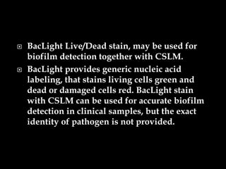 Biofilms in otorhinolaryngology | PPTX