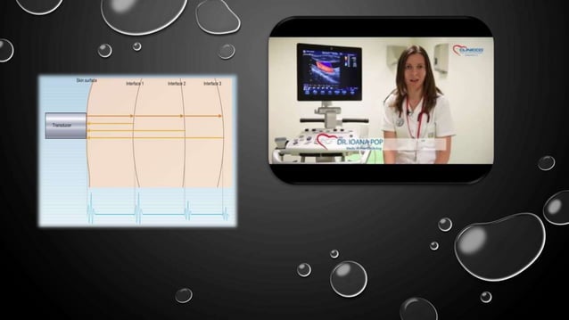 biofizica-ecografia.pptx