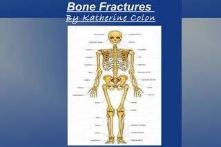 Bio fracture | PPT
