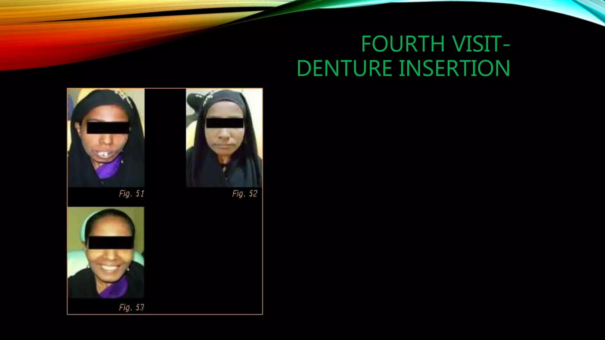 Biofunctional prosthesis system complete denture | PPTX