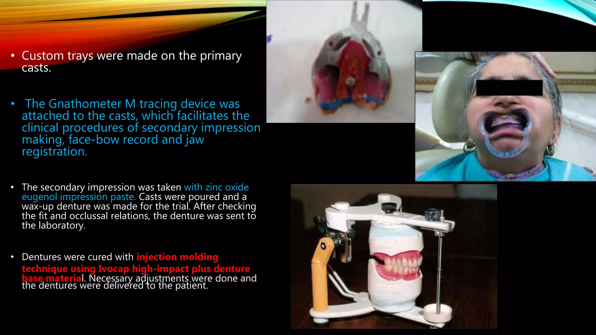 Biofunctional prosthesis system complete denture | PPTX