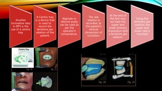 biofunctional prosthesis system complete denture.pptx