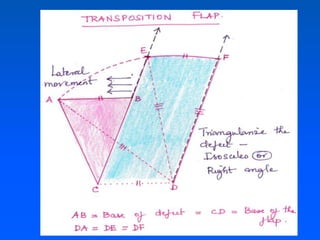 Biogeometry of transposition flap | PPTX