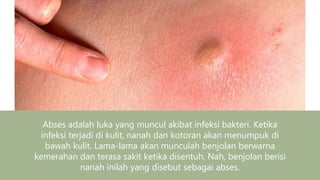 Bioglass untuk abses | PPT