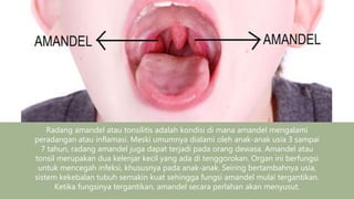 Bioglass untuk amandel | PPT