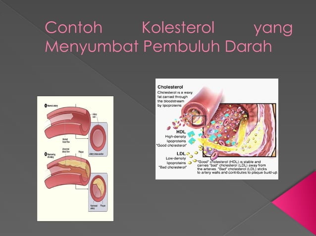 Pemeriksaan Biokimia (Kolesterol) pada Kimia Klinik | PPTX