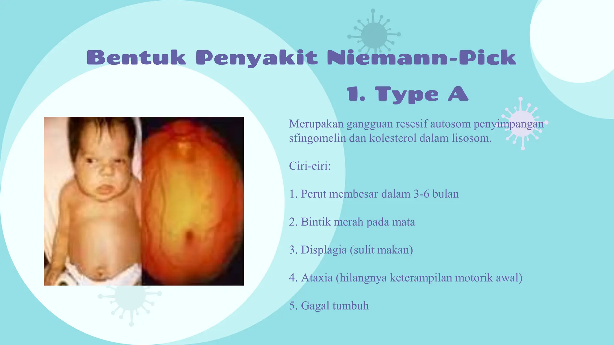 BIOKIMIA-Kelainan metabolisme lipid (penyakit Niemann-Pick).pptx