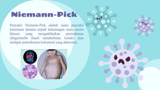 BIOKIMIA-Kelainan metabolisme lipid (penyakit Niemann-Pick).pptx