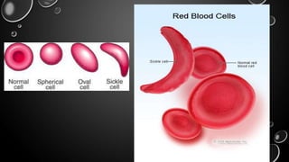 BIOKIM I Sickle Cell | PPTX