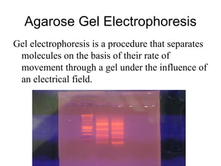 Biol2 Lecture 2 Dna Isolation And Agarose Gel | PPT
