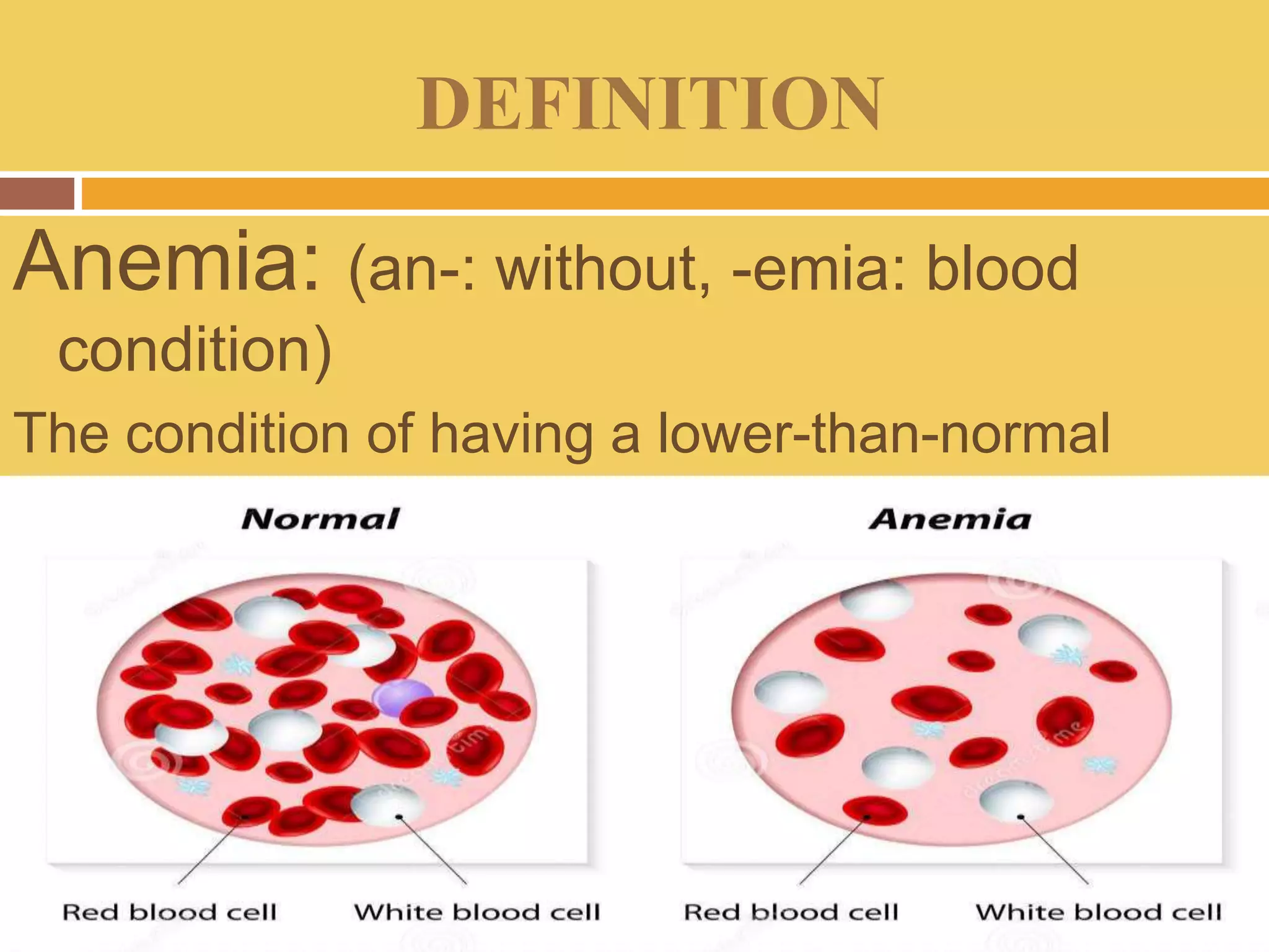 Anemia | PPTX